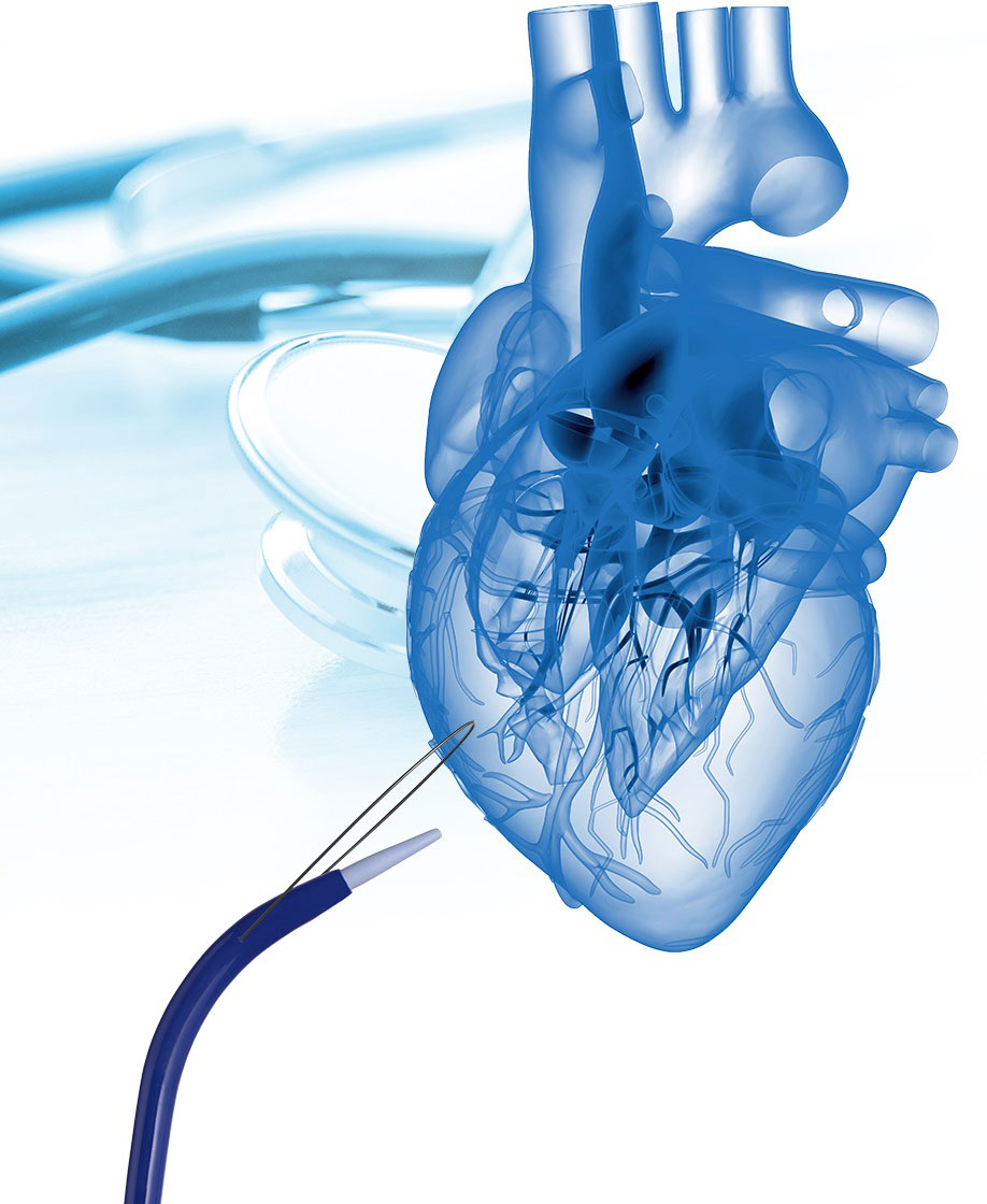 Transseptal Solutions - Advanced steerable transseptal puncturing system